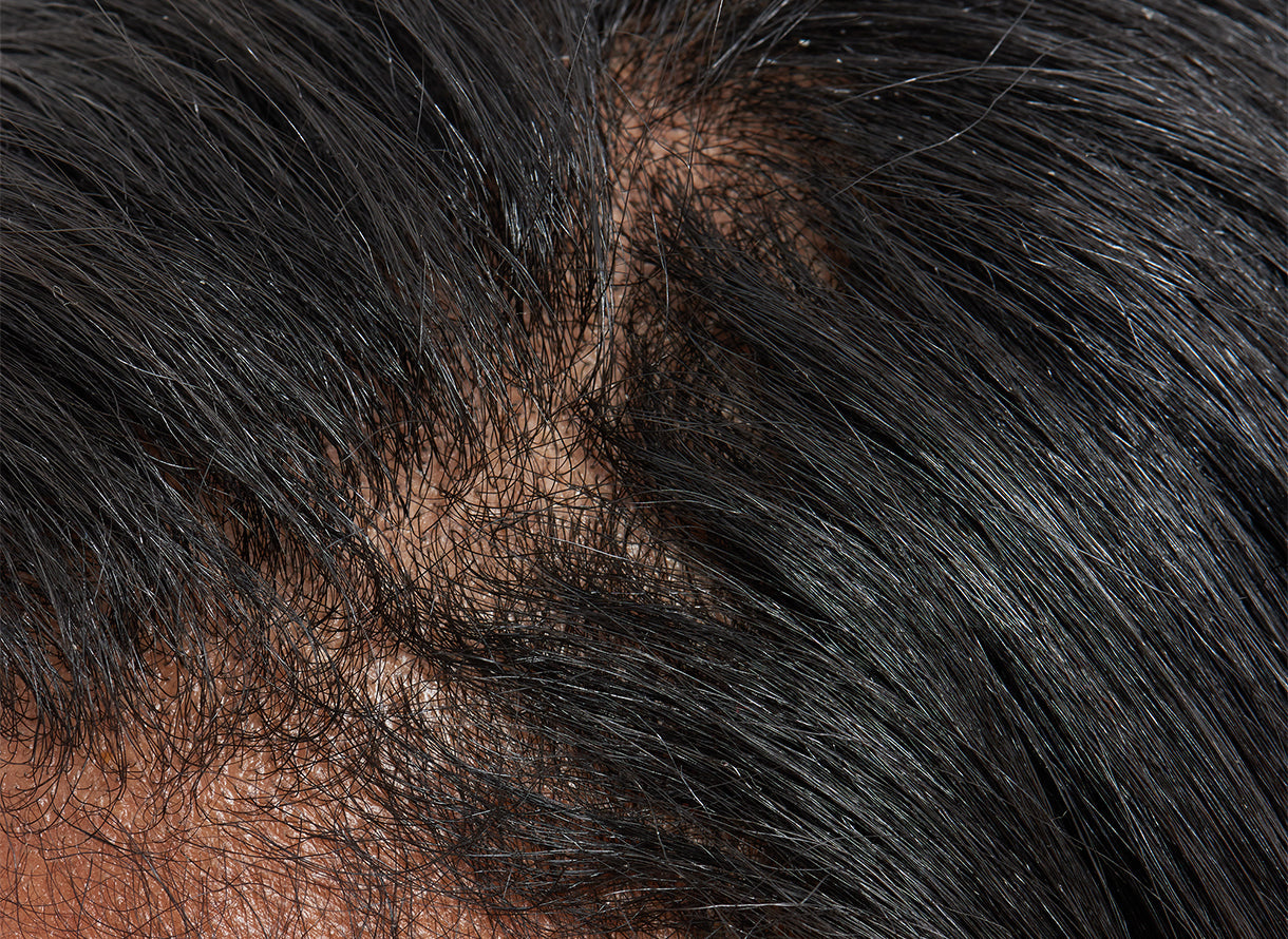 How to prevent hair loss and thinning hair | The INKEY List